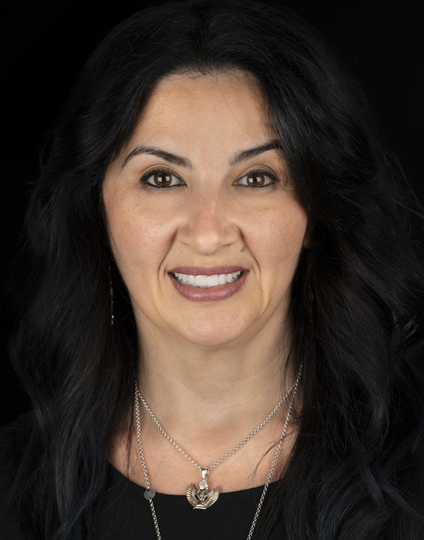 Results Gallery | All on Four, Implants, BL3 Veneers | Happy Smile