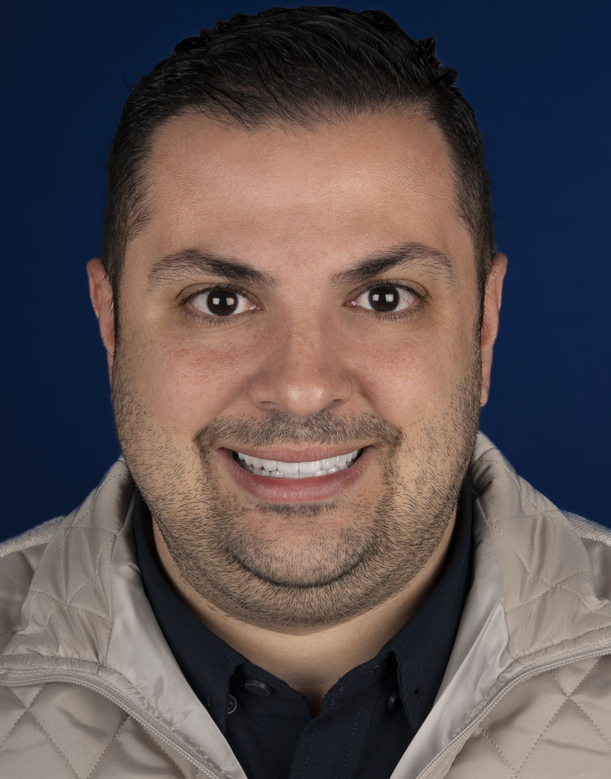 Results Gallery | All on Four, Implants, BL3 Veneers | Happy Smile